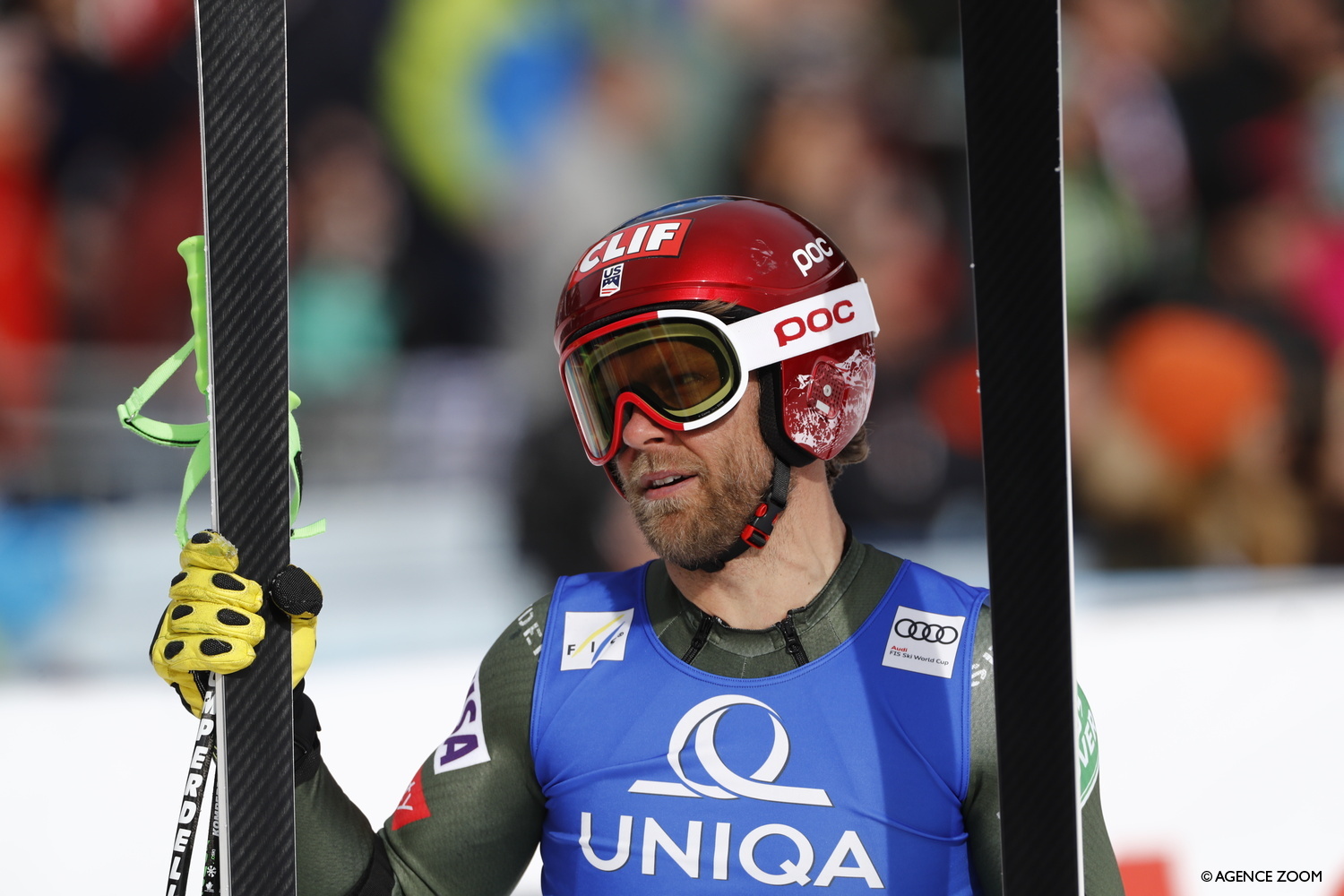 FIS | Steven Nyman Suffers Achilles Tendon Injury